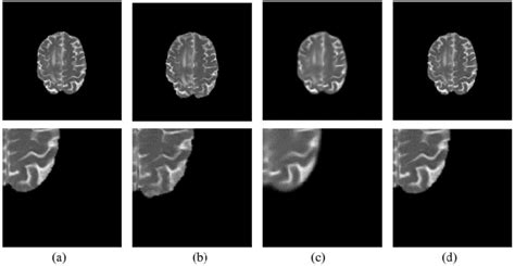 Denoising Detail Effect Of MRI Image Under Pink Noise With The Download Scientific