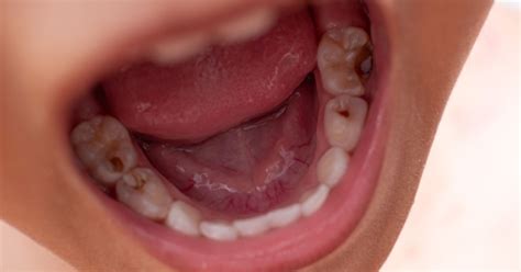 Cómo Cuidar La Salud Bucal De Tus Hijos Para Que Vivan Una Infancia Sin