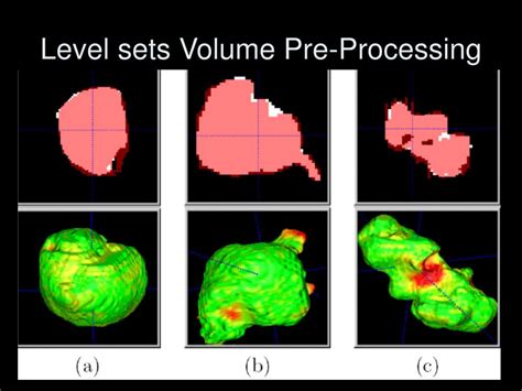 Ppt State Of The Art Report 2004 On Gpu Based Segmentation Powerpoint Presentation Id307529