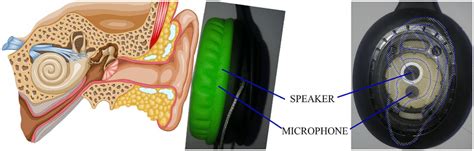 A Device For Recording Acoustic Patterns Of The Outer Ear Download