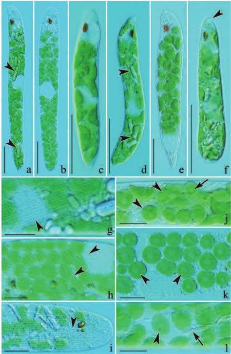 Fic 1 Light Microscope Photographs Showing The General