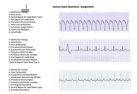 Solved Lecture Exam Questions Assignment 1 Identify The Tracing A Sinus Arrest B Second
