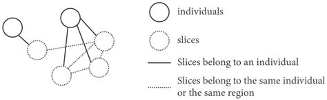 Motion Artifact Detection Based On Regionaltemporal Graph Attention