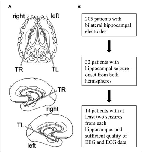 Implantation Scheme And Flowchart Of Patient Selection Placement Of Download Scientific