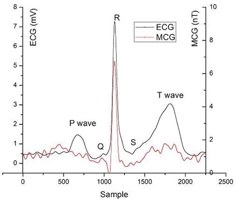 Magnetocardiogram Electrocardiogram Download Scientific Diagram