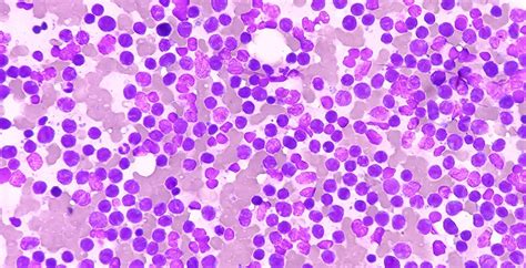 Vision Langauge Models Vlm In Medicine A Review By Abdulkader Helwan Jul 2024