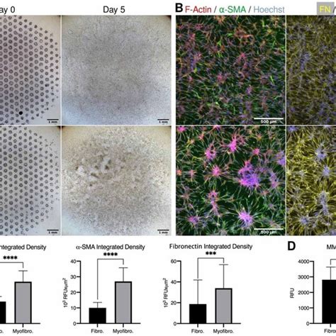 Maintenance Of Fibroblast And Myofibroblast Phenotypes With Maturation Download Scientific
