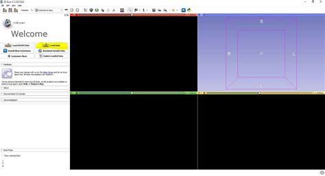 How To Convert Nrrd File To Dicom For 3d Printing Medimodel
