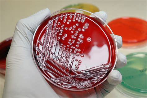 Multi Resistant Coliform Bacteria Uconn Today