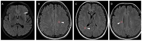 Sensors Free Full Text Optical Coherence Tomography In The Differential Diagnosis Of