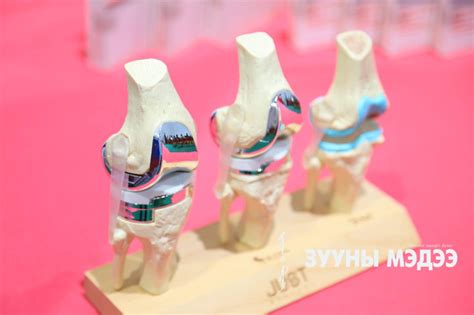 ФОТО Монголын гэмтэл согог судлалын эмч нар чуулав