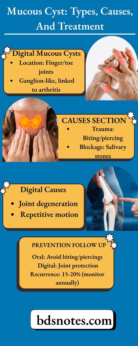 Mucous Cyst Types Causes And Treatment Bds Notes