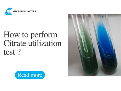 How To Perform A Citrate Utilization Test Microbial Notes