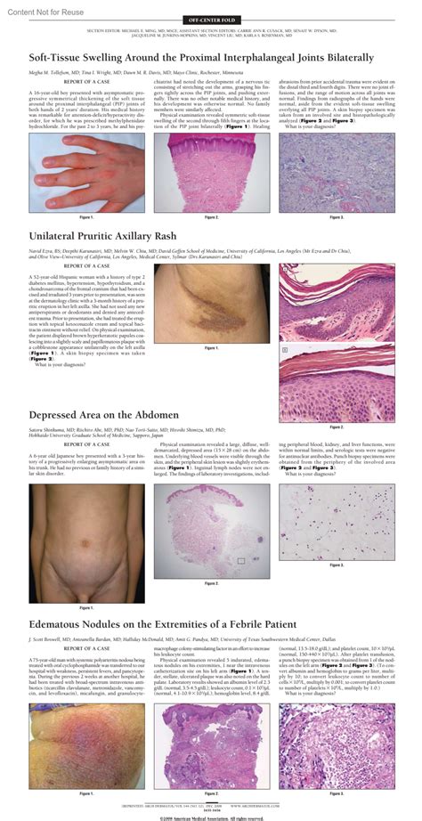 Soft Tissue Swelling Around The Proximal Archives Of Dermatology