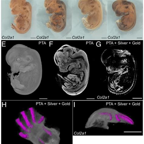 Detection Of Collagen Type 2 Alpha 1 Col2a1 Expression With µct A Download Scientific