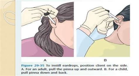 Instilling Ear Medicationpptx Ear Nose And Throat Conditions