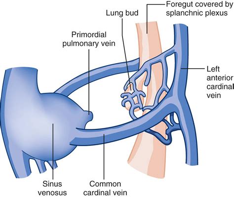 Surgical Considerations In Pulmonary Vein Anomalies Clinical Tree