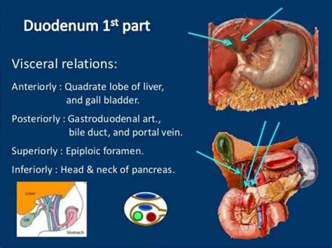 Anatomical And Functional Variations Of Duodenum Ppt Free Download