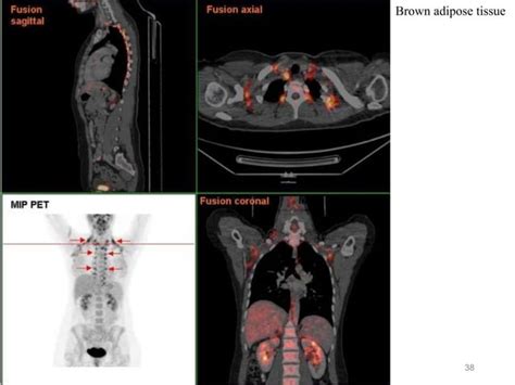 Adipose Tissue Histology Pptx