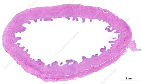 Urinary Bladder Light Micrograph Stock Image C0567710 Science