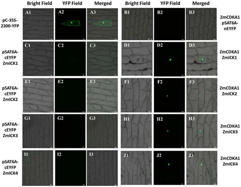 Bimolecular Fluorescence Complementation Analysis Of Zmick1 Zmick2 Download Scientific