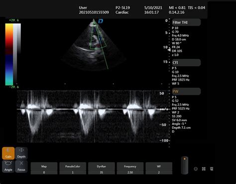 3d 4d Portable Color Doppler Ultrasound Machine From China Manufacturer Dawei Medical
