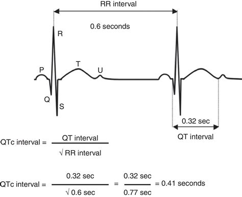 Prolonged Qt Interval Corrected For Heart Rate During Long Qt Syndrome