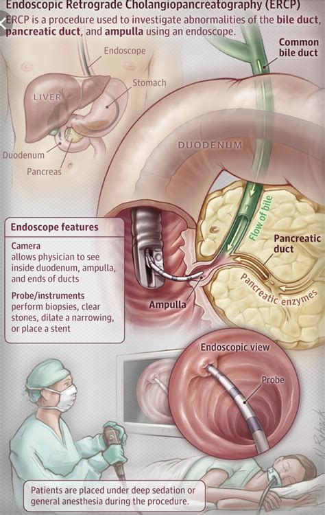 Ercp Again — Gather With Jim