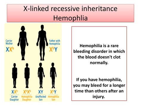 Ppt Sex Linked Inheritance Powerpoint Presentation Free Download