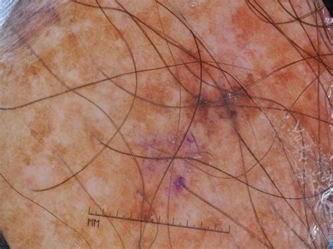 Courtesy Images From Isbi 2017 Challenge Original Images Without Download Scientific Diagram