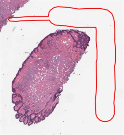 How To Export Tiles Of Large Histology Images In Qupath Blog Posts Image Sc Forum