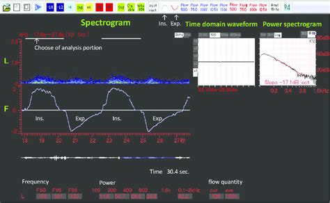 Sound Spectrogram Display Of Lung Sounds In A Patient Easy Lsa The Download Scientific