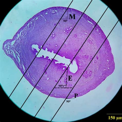 The Orthogonal Intercept Method For Measurement Of The Different Layers