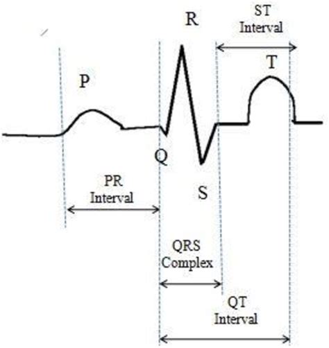Figure 1 From Survey On Electrocardiography Signal Analysis And Diabetes Mellitus Unraveling