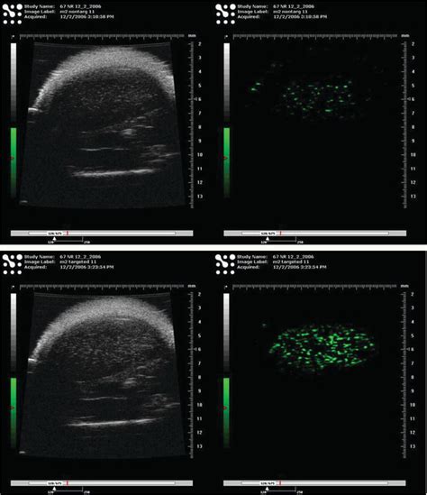 Molecular Sonography Current And Future Applications Intechopen