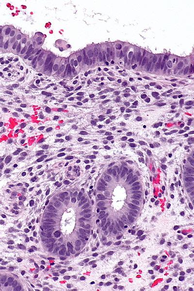 Difference Between Endometrium And Myometrium Pediaa Com