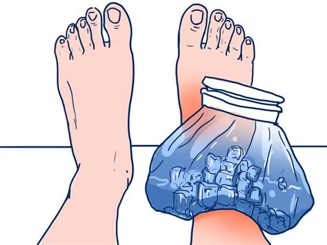 脚踝扭伤千万不要这么做 搜狐大视野 搜狐新闻