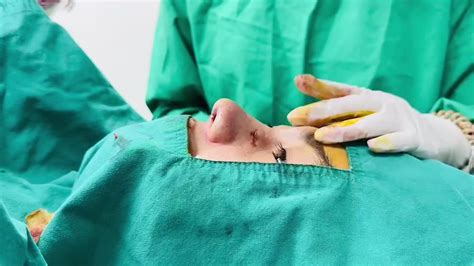 💓 ทรงที่เห็นชัดที่สุด ยื่น1 แก้จมูกฟลูอ๊อฟชั่น ⭐ ราคาโปรรีวิว 19 999 รวมแก้ รายการในโปร