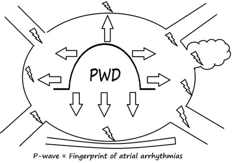 The P Wave Fingerprint Of Atrial Arrhythmias Is A Marker Of Atrial