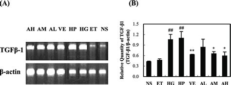 Effect Of As I On The Relative Quantity Of Tgf β1 Mrna In Rat Mesangial Download Scientific
