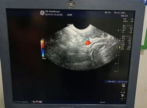 3d4d Ge Logiq F8 Ultrasound Machine Monitor Size 23 Inch At Best