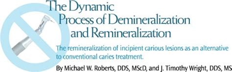 The Dynamic Process Of Demineralization And Remineralization