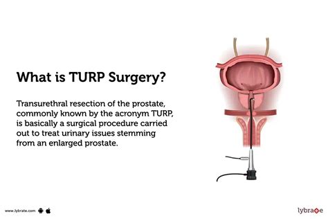 Transurethral Resection Of The Prostate