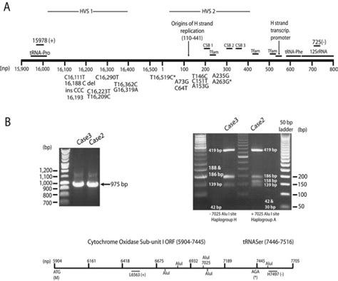 Clinical And Functional Characterization Of A Human Ornt1 Mutation