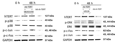 Telomerase Reverse Transcriptase Promotes The Proliferation Of Human Laryngeal Carcinoma Cells