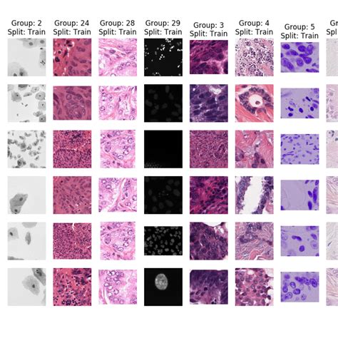 Nuclei Segmentation In Microscope Cell Images Kaggle