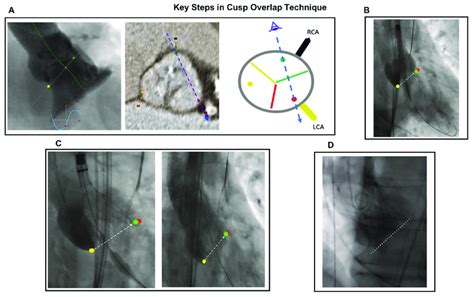 Key Steps In Cusp Overlap Technique A Step 1 A Reconstructed Download Scientific Diagram