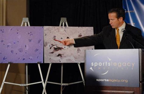 Doctor Pro Wrestler Benoits Concussions May Have Contributed To Killings Of Wife Son