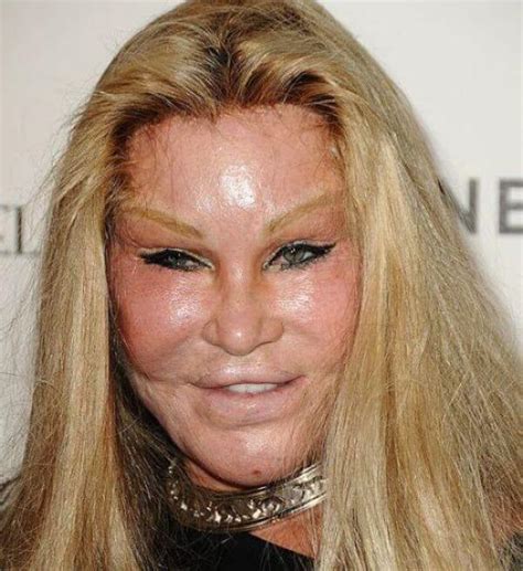 What S Wrong With Plastic Surgery At Emma Sparks Blog
