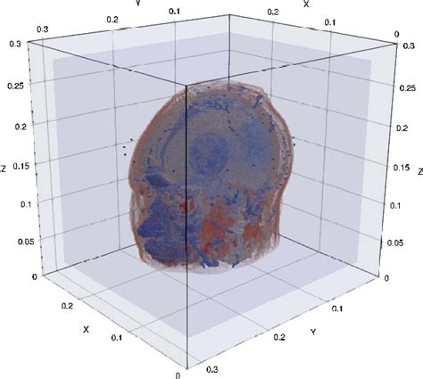 Figure 1 From Variable Exponent Lebesgue Space Inversion For Brain Stroke Microwave Imaging